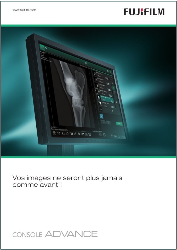 FUJI DEVO3 équin - Fujifilm Vet Systems France